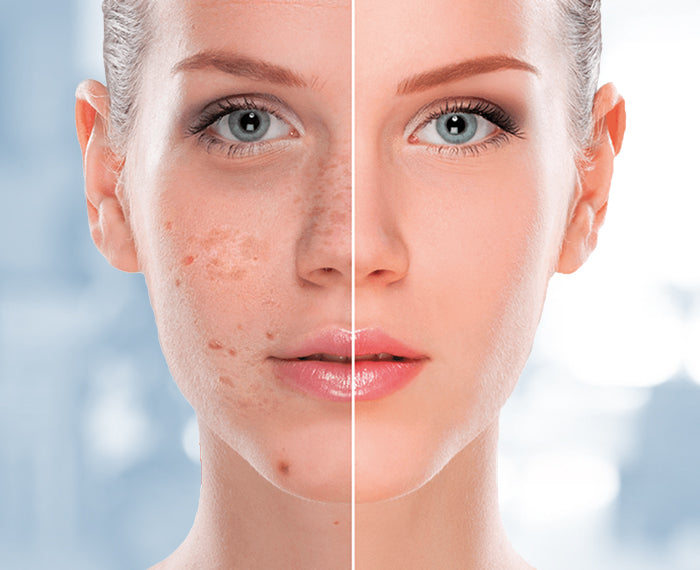 Dermocosmetics – IslaPlus